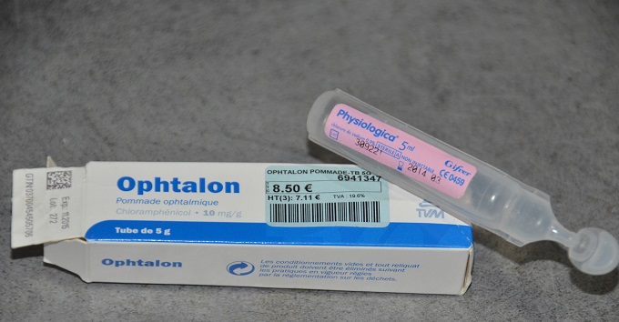 Conjonctivite de la tularémie - Ophtalmologie