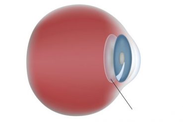 Méthodes d'examen du cristallin - Ophtalmologie