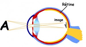 Affections de la rétine - Ophtalmologie