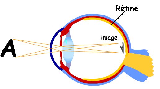 Affections de la rétine - Ophtalmologie