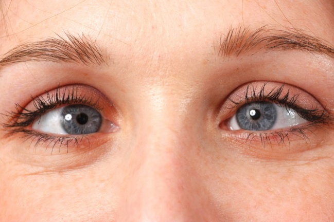 Phase de décollement de la rétine - Ophtalmologie