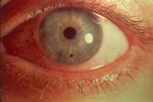 Ophtalmplogie.pro, le Guide de Référence de la Santé des Yeux