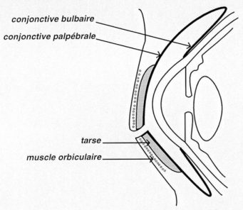 Symptomatologie du zona ophtalmique - Ophtalmologie