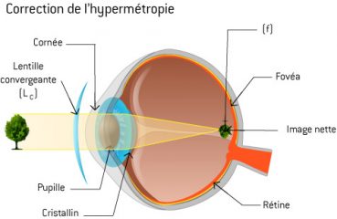 Traitement de l'hétérophorie - Ophtalmologie