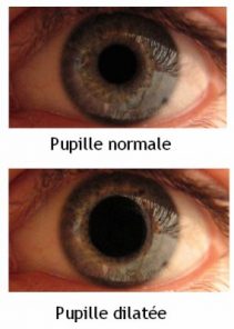 Réactions et divers réflexes de la pupille - Ophtalmologie