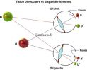 L'examen de la vision binoculaire - Ophtalmologie