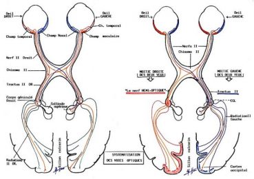 Affections congénitales du système nerveux - Ophtalmologie