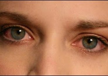 La médication anti-infectieuse - Ophtalmologie